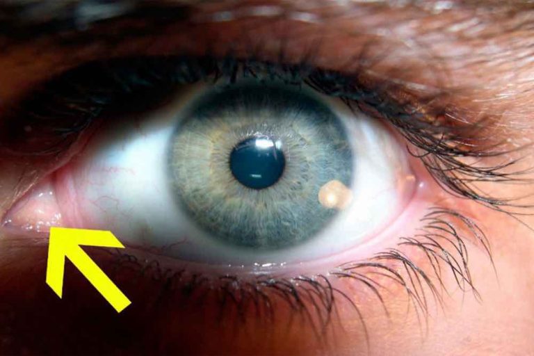 Pliegue semilunar - En Ojopedia