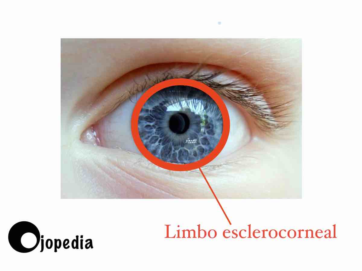 Limbo esclerocorneal - En Ojopedia
